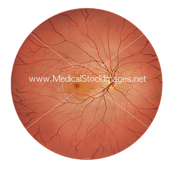 Normal (Healthy) Fundoscopy View of the Retina – Medical Stock Images ...