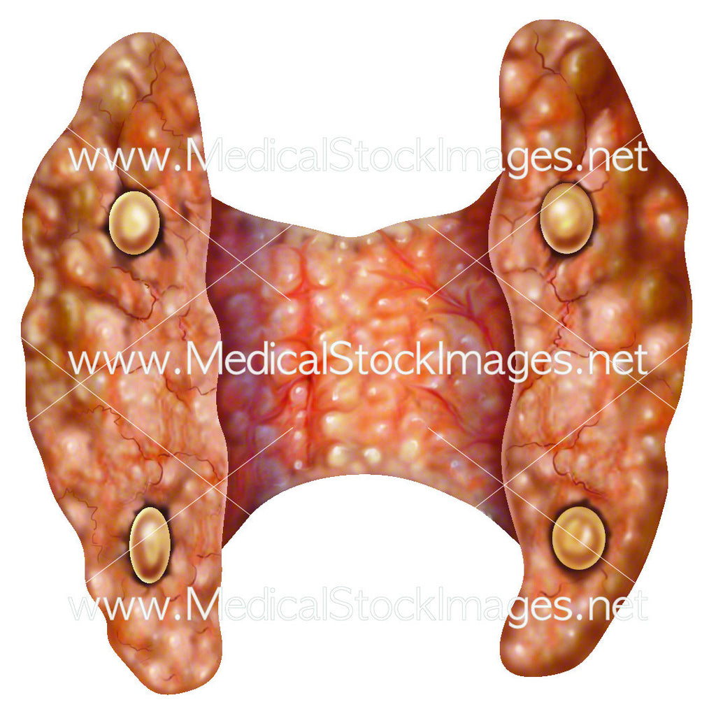Parathyroid Gland Location