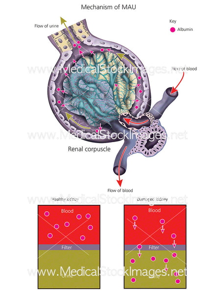 MAU Diagram – Medical Stock Images Company