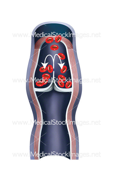 Venous Return Flow with Closed Valve – Medical Stock Images Company
