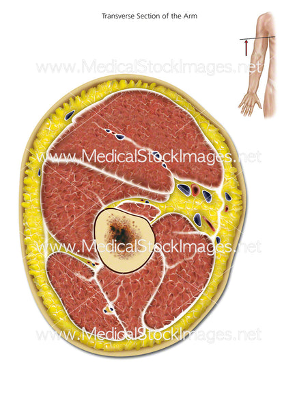 Transverse Section of the Arm in Context – Medical Stock Images Company