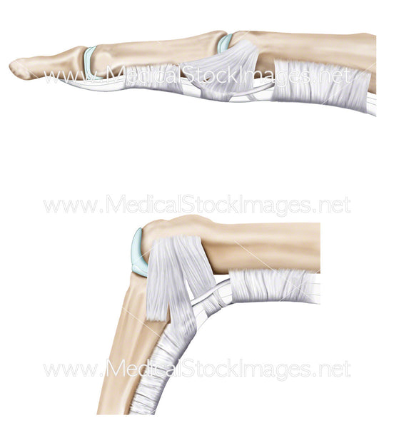 Ligaments of the Finger when Stretched and Relaxed – Medical Stock ...