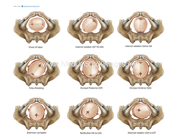 License Cardinal Movements of Labour (Baby of African heritage ...
