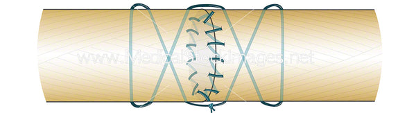 Kleinert Suture – Medical Stock Images Company